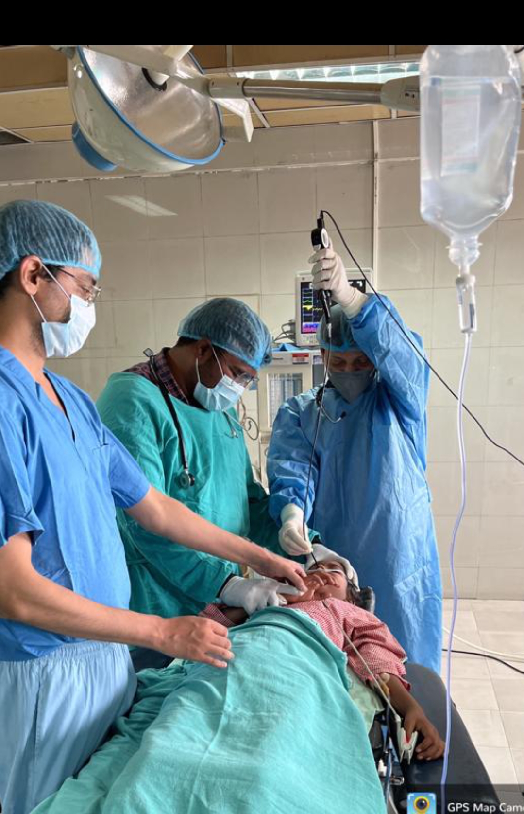 Incidental diagnosis of Tuberculosis on Bronchoscopy,Dr.Deo Kumar Jha,M ...